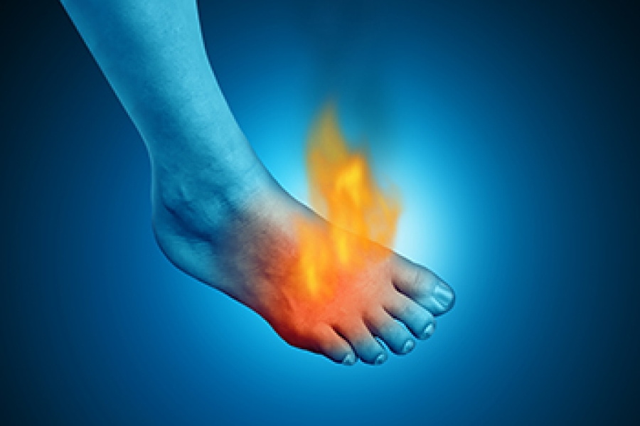My feet is burning store